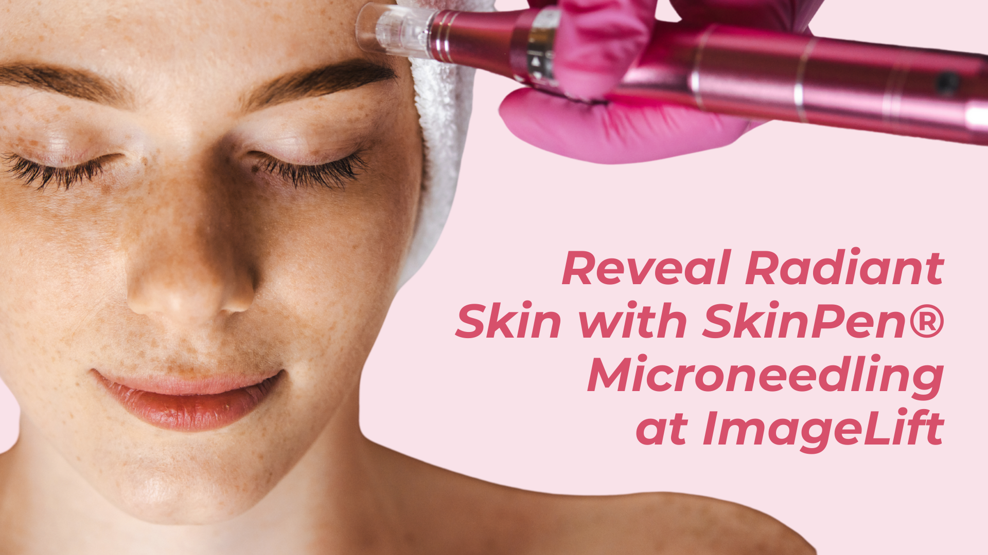 Reveal Radiant Skin with SkinPen® Microneedling at ImageLift | Dr ...