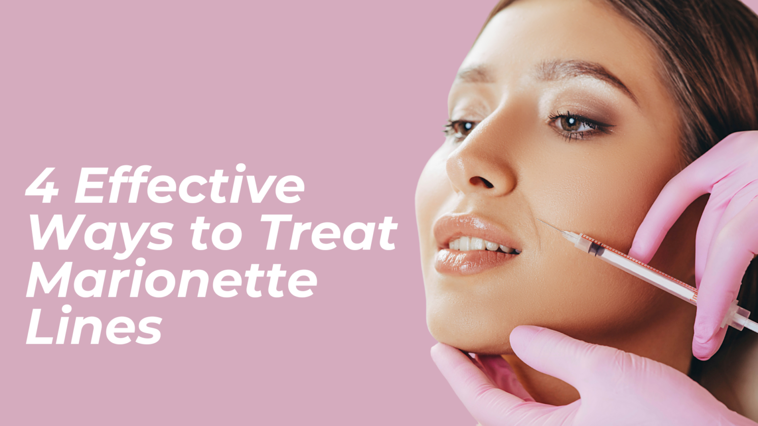 4 Effective Ways to Treat Marionette Lines | Dr. Castellano ImageLift ...